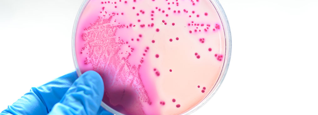 Megamonas – bakteria, która może pogrubiać - Praktyczny serwis dla ...