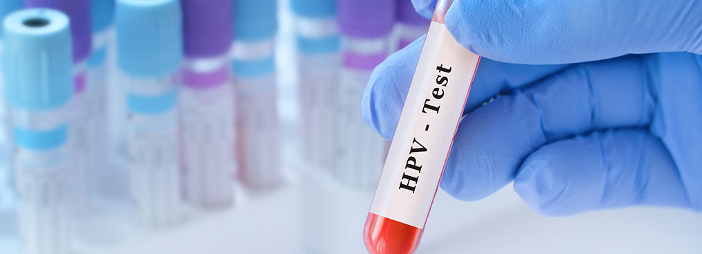 Wcześniej niedostępny, teraz na NFZ: test HPV HR – skuteczniejsza ...